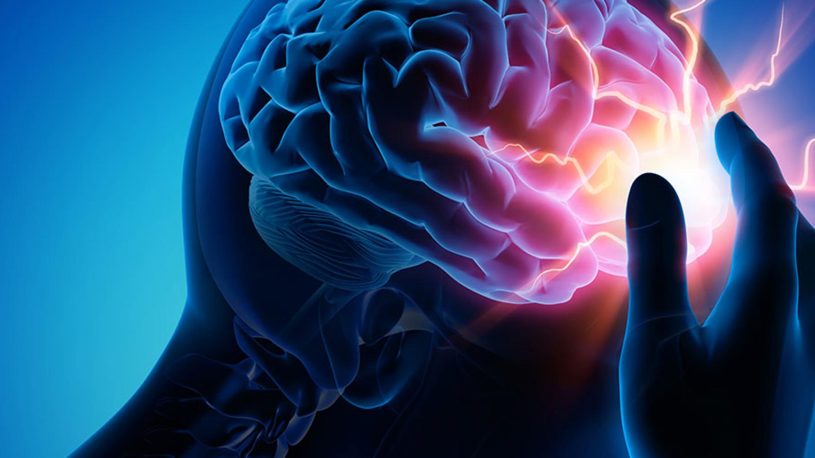 Concussion Discussions: Managing the Concussed Athlete • Compete Sports ...